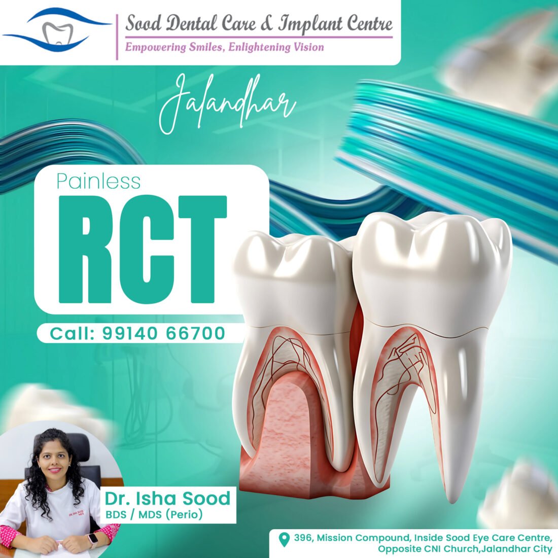 Root Canal Treatment (RCT) Cost in Jalandhar | Sood Dental Care